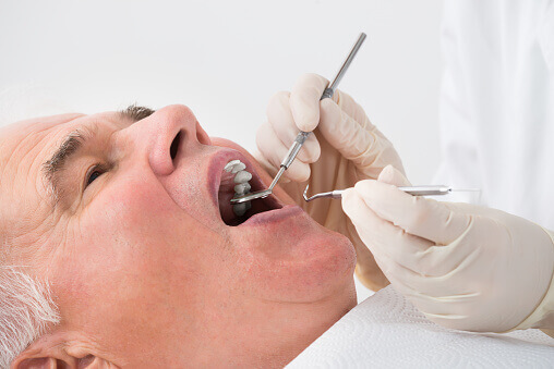 Home Care Dentist San Fernando | House Call Dental Care | Home Dental Care